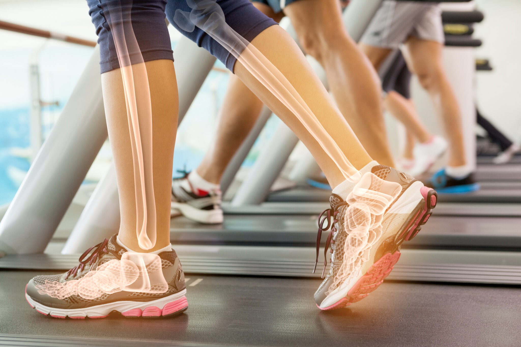 How To Build Healthy Bones Naturally EHealth Connection